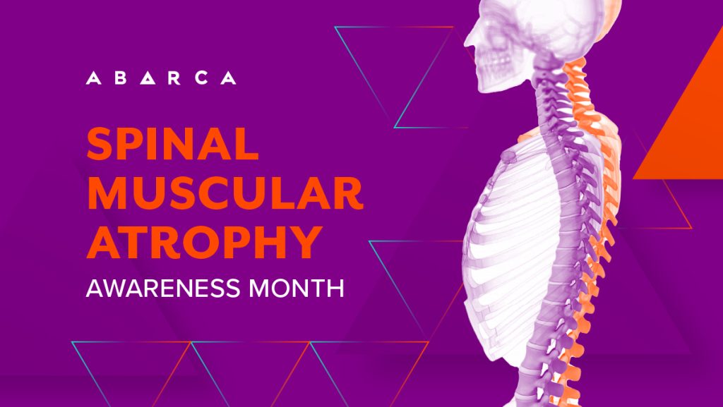 How We Think--Abarca is a different kind of company